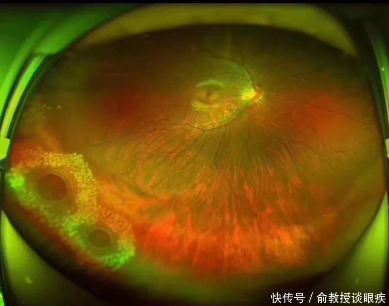文章图片