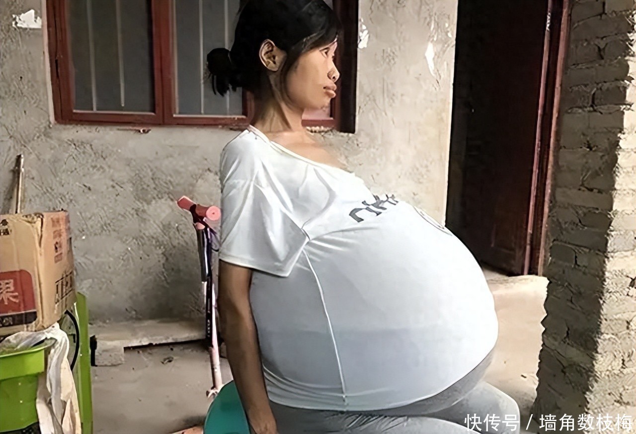 文章图片