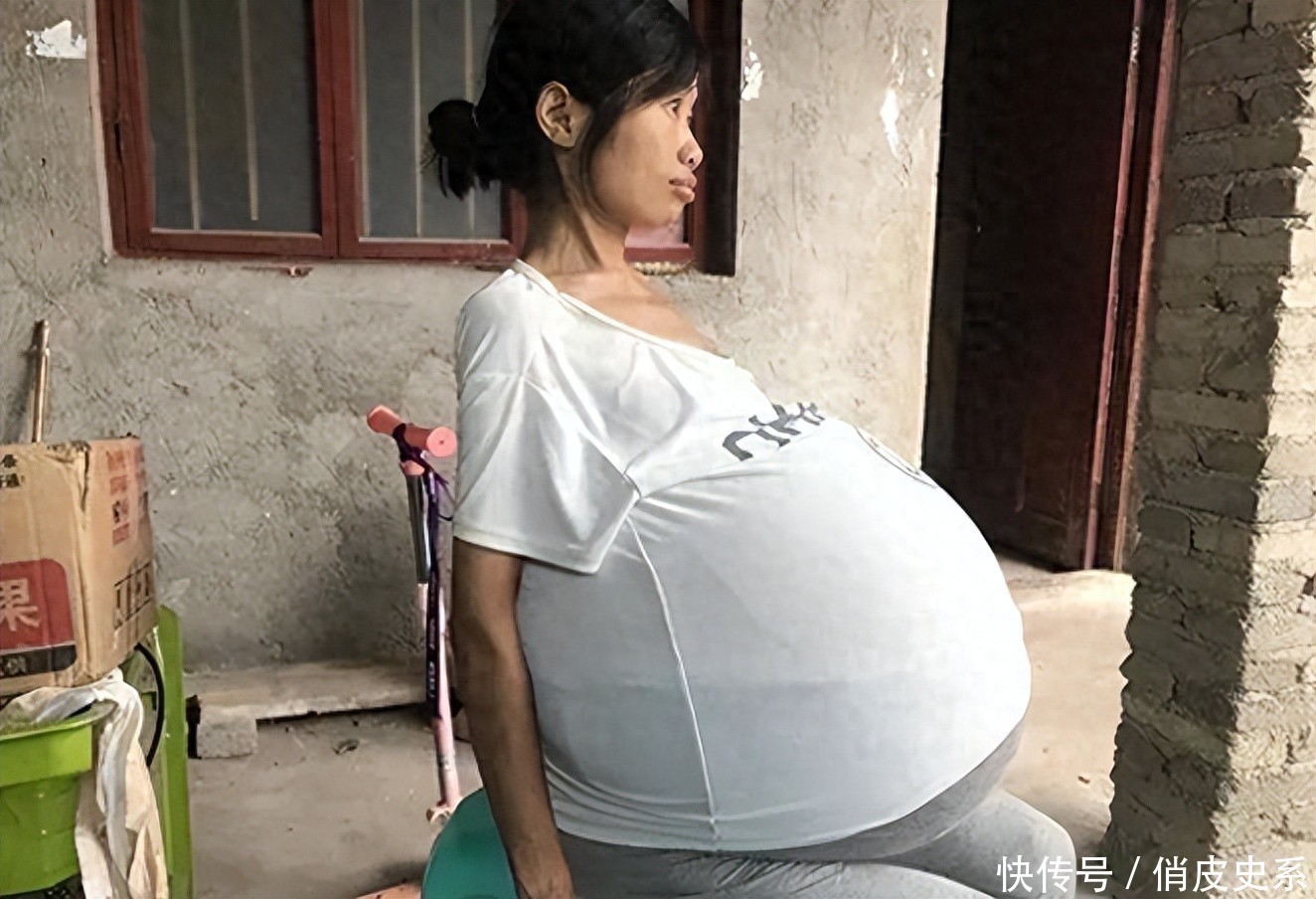 文章图片