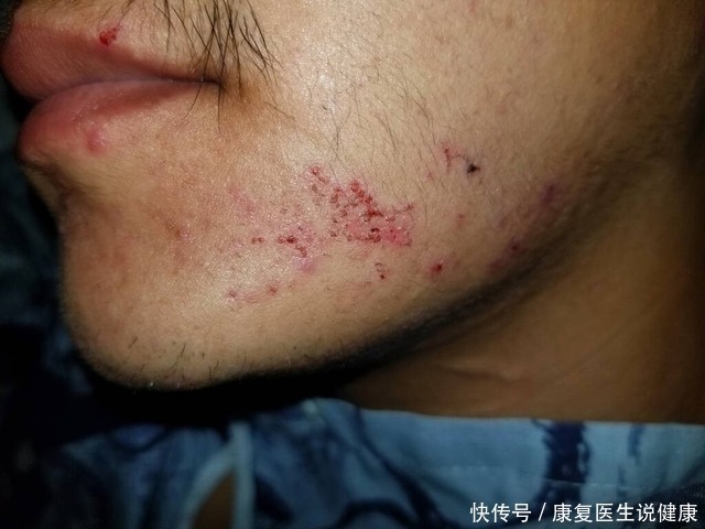 文章图片