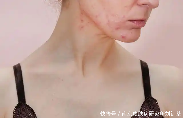 文章图片