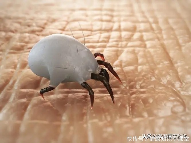 文章图片