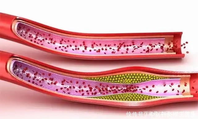 文章图片