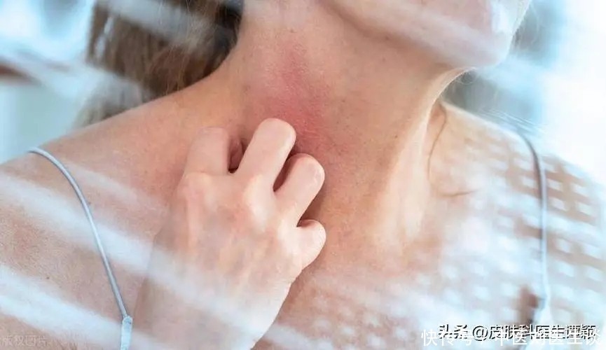 文章图片
