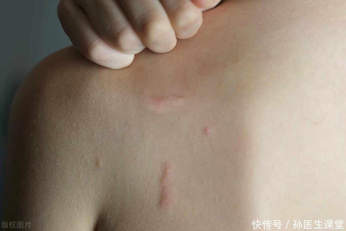 文章图片