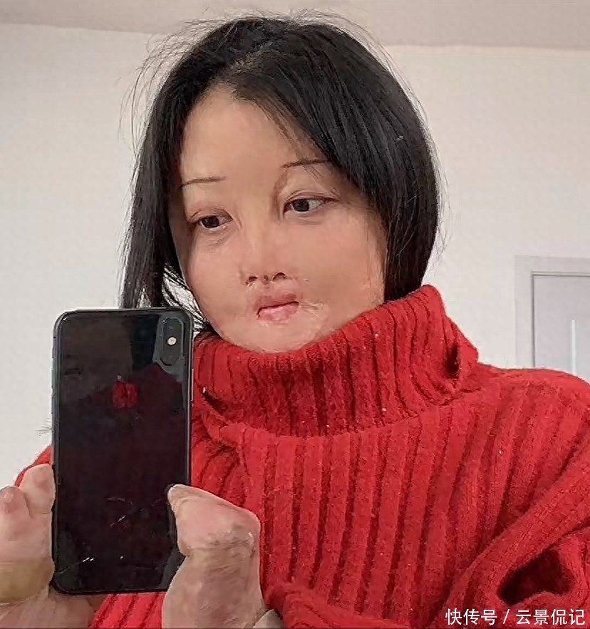 文章图片
